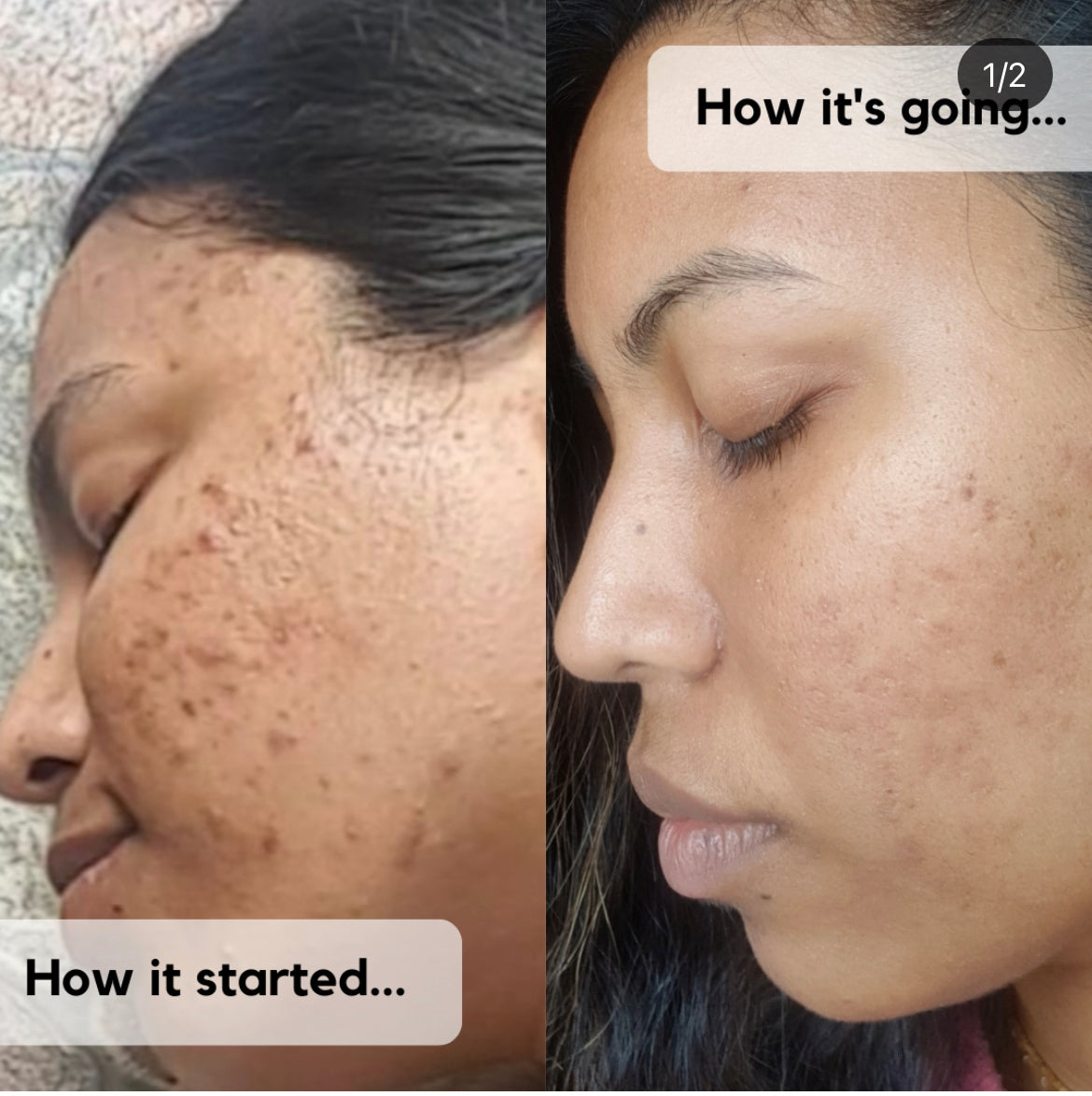 Organic Anti-Aging Marula Oil Serum for Glowing Skin | Standard Beauty ...