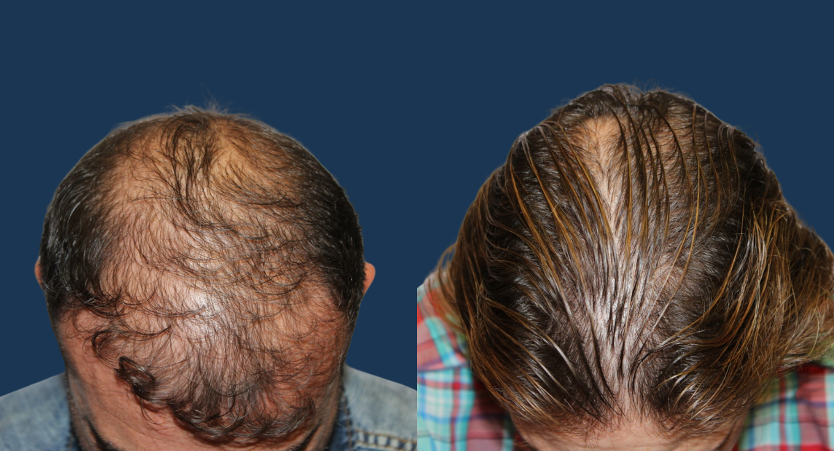 Men – Standard Skin & Beauty