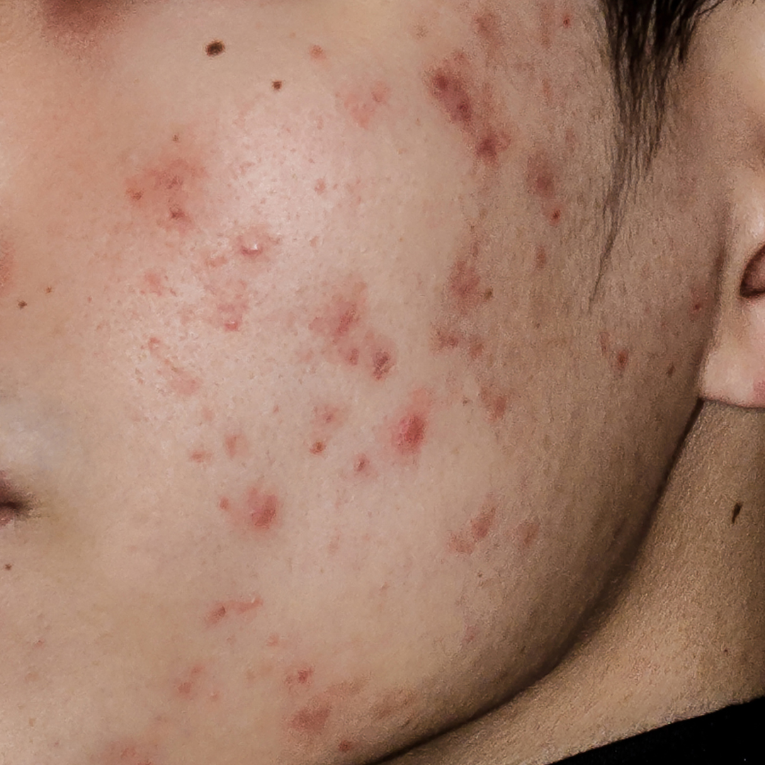 Men – Standard Skin & Beauty
